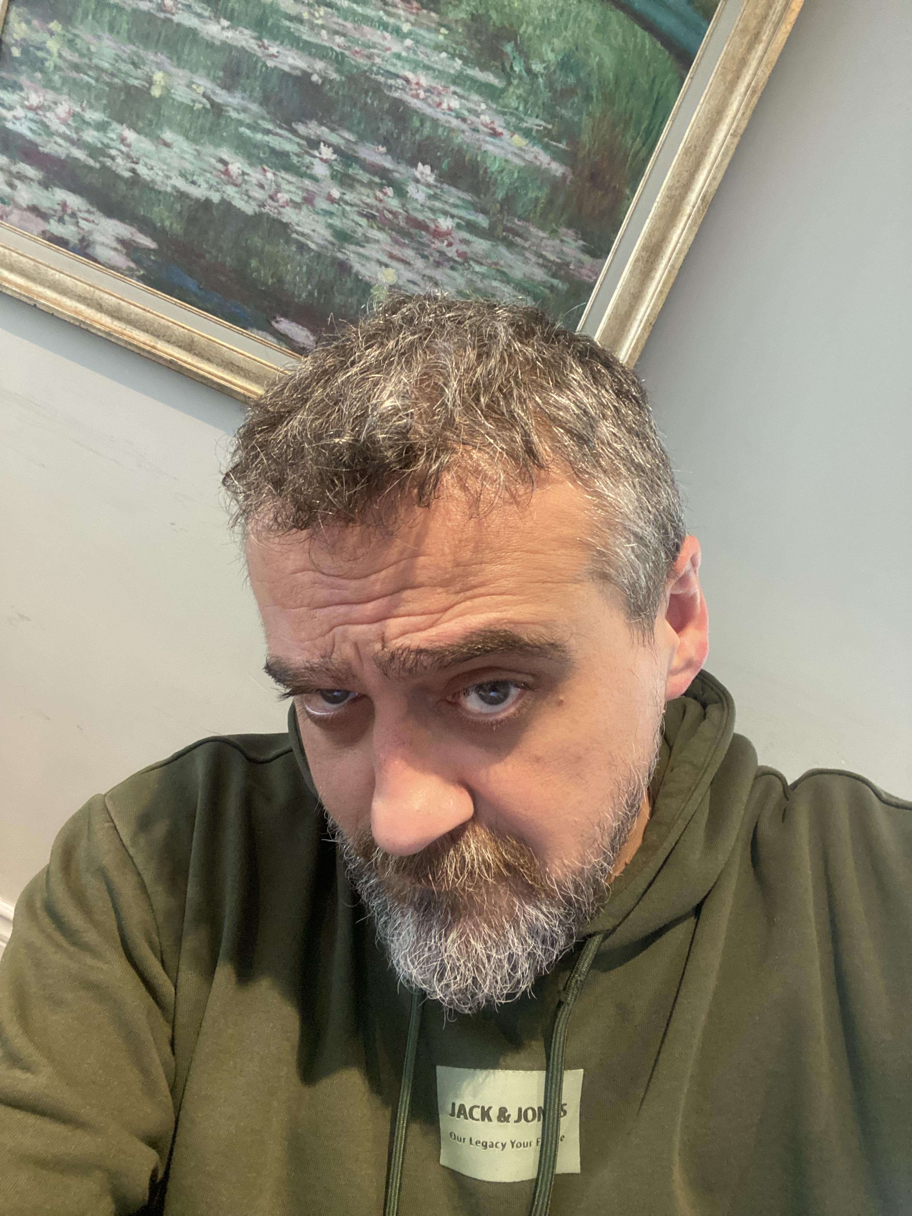 saçlı evlendiği adam kel kalan kadın #2463649 - uludağ sözlük galeri